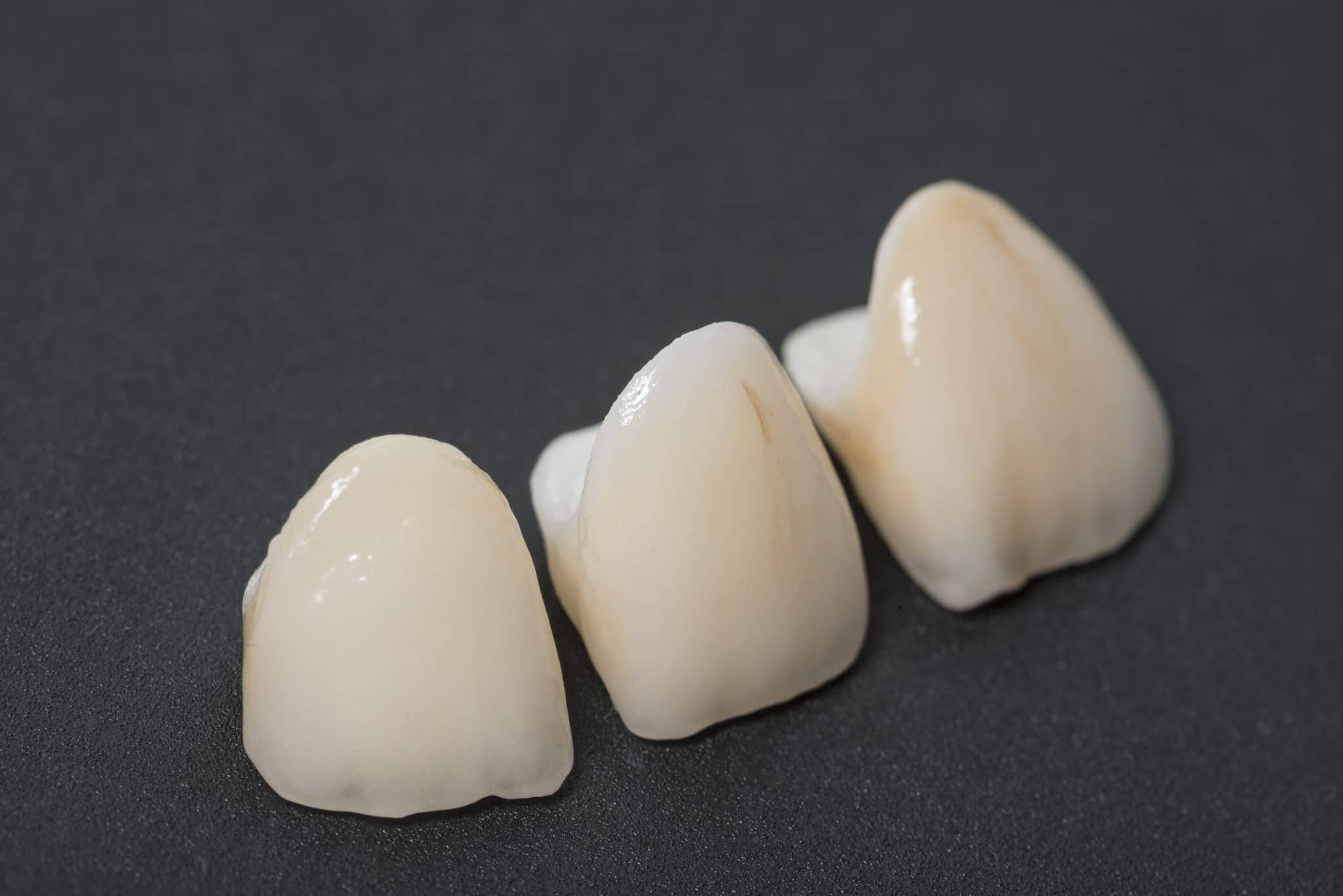 Omaha Dentist Creates Full And Partial Crowns In One Visit | Omaha, NE